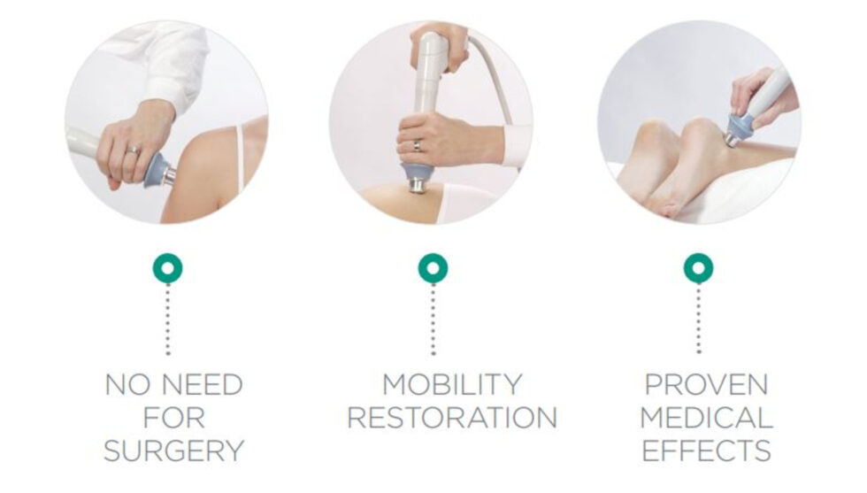 Shockwave Therapy for Pain Relief | Non-Surgical Treatment in Hertfordshire